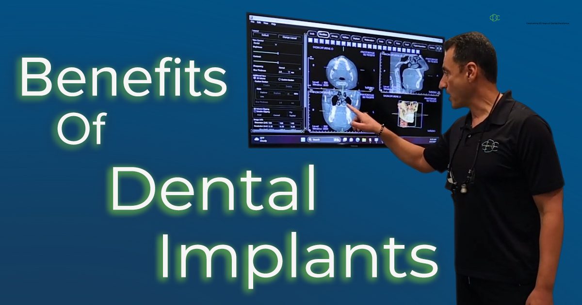 Dental Implants - Clinton Dental Center